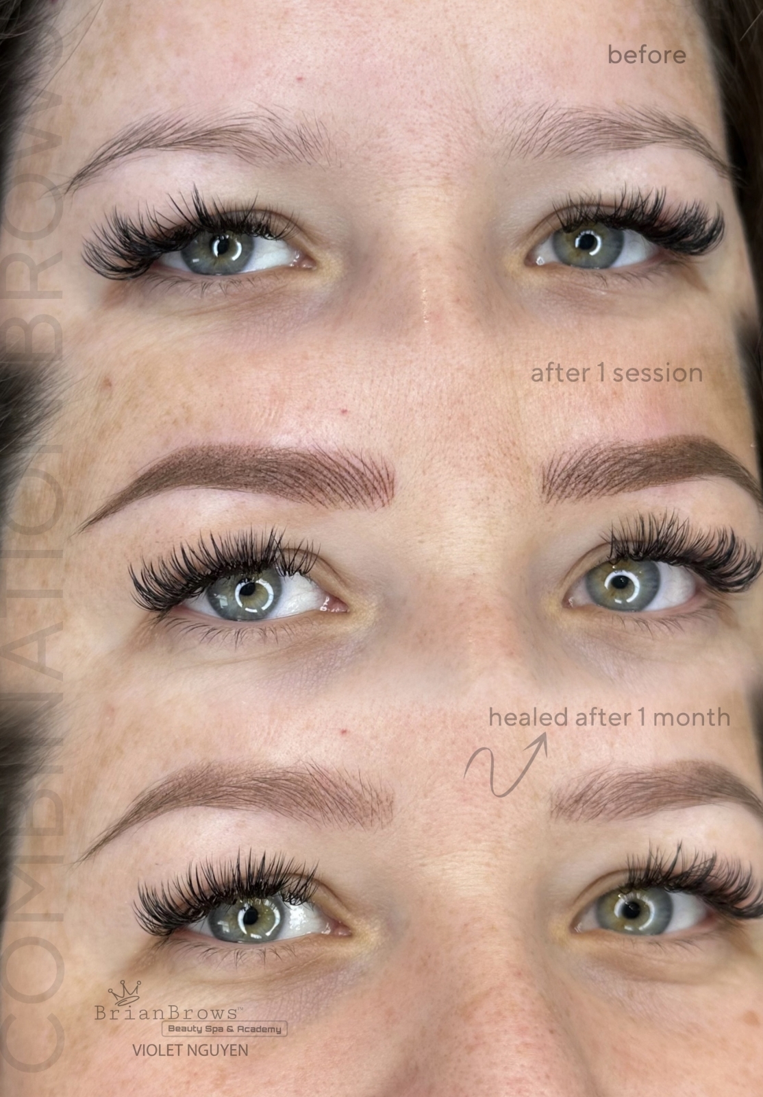 WHAT DOES THE HEALING PROCESS OF YOUR NEW BROWS LOOK LIKE?